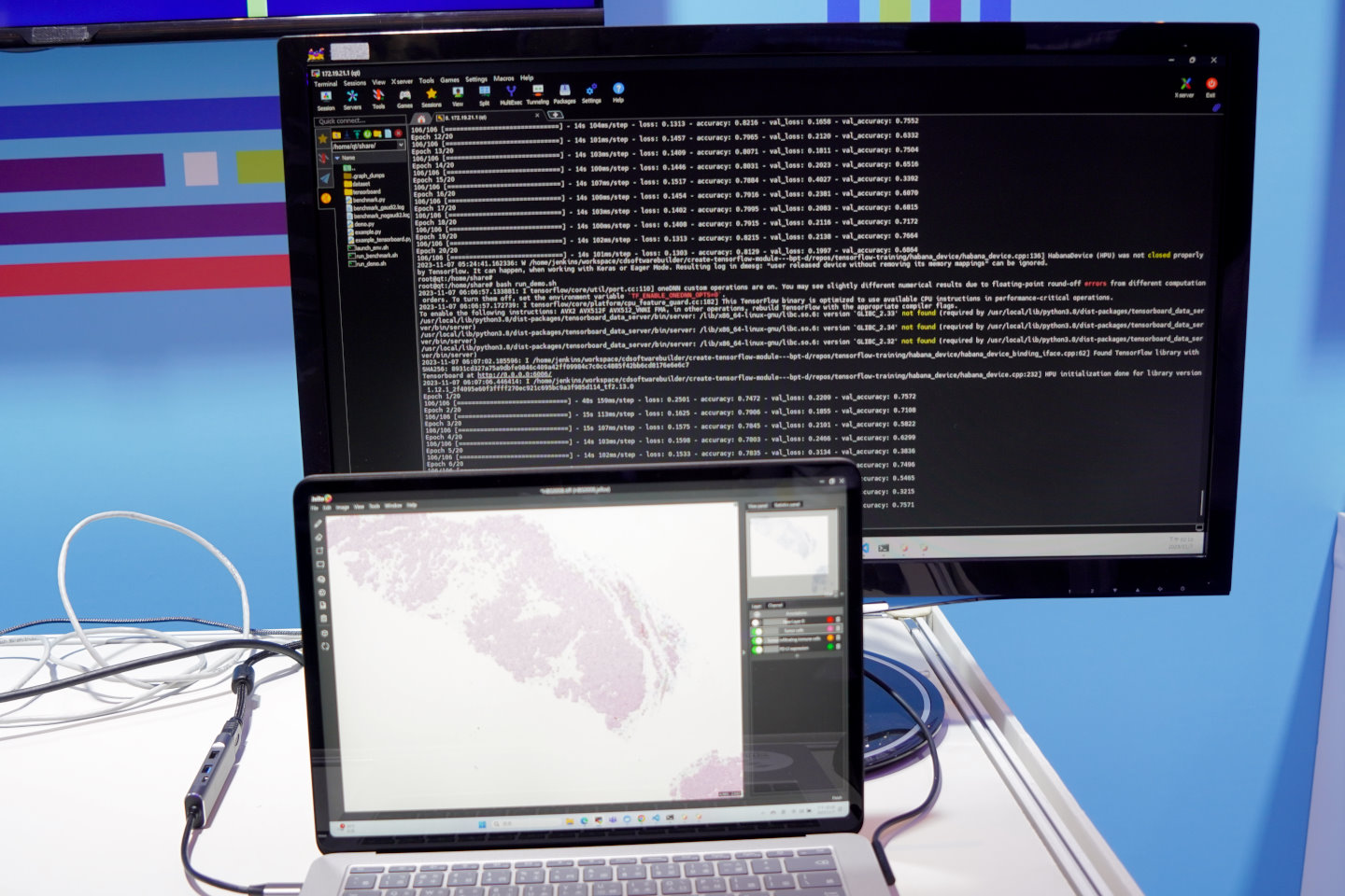 Intel Innovation Taipei 2023：透過Gaudi 2訓練與最佳化大型語言模型，還有醫療影像辨識實際展示 | T客邦